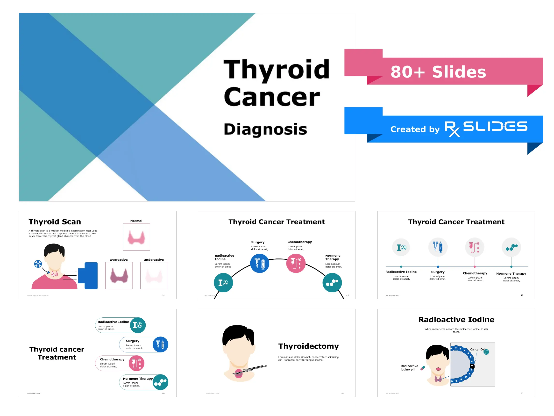 Download Thyroid Cancer PowerPoint Template|RxSlides